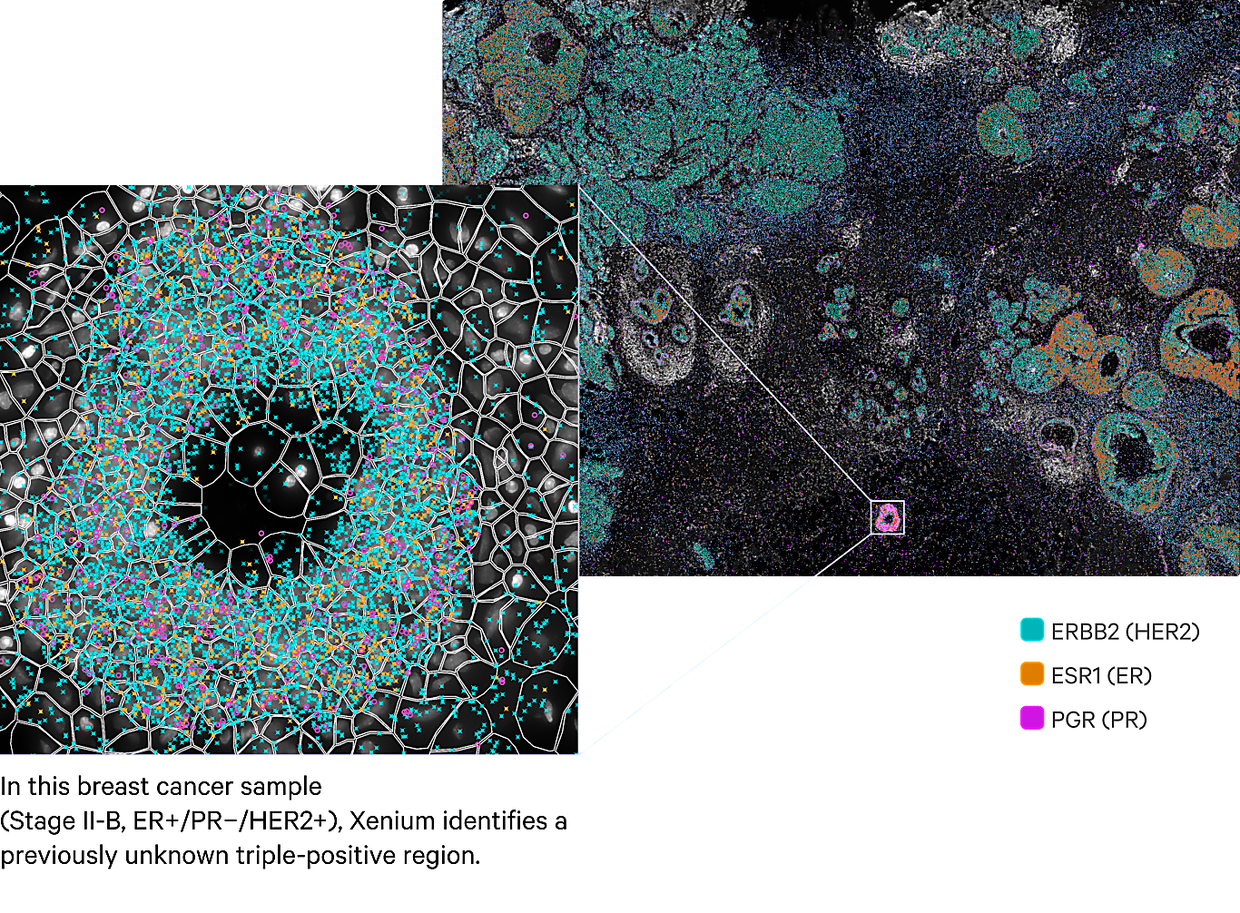 A more precise way to find the needle in the haystack: Identifying rare biology with Xenium In ...